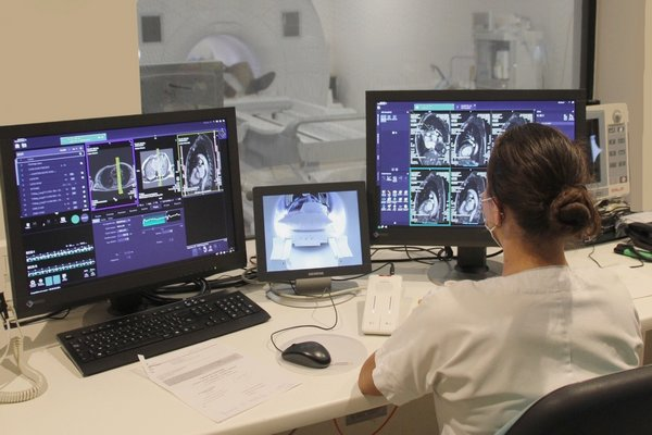 Dr Nicolas Falvo Médecin Angiologue Interventionnel CHU Dijon